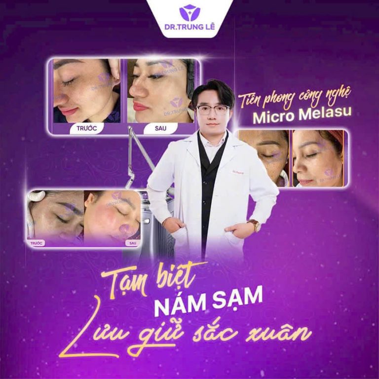 Công Nghệ Trị Nám Mirco Melasu Nhật Bản - Sạch Tận Gốc Nám